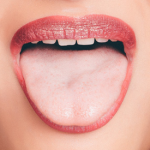 Como falo afta em inglês? – Inglês Online